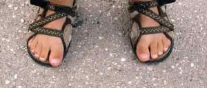 How To Stop Little Toe Poking Out Of Sandals | Footted